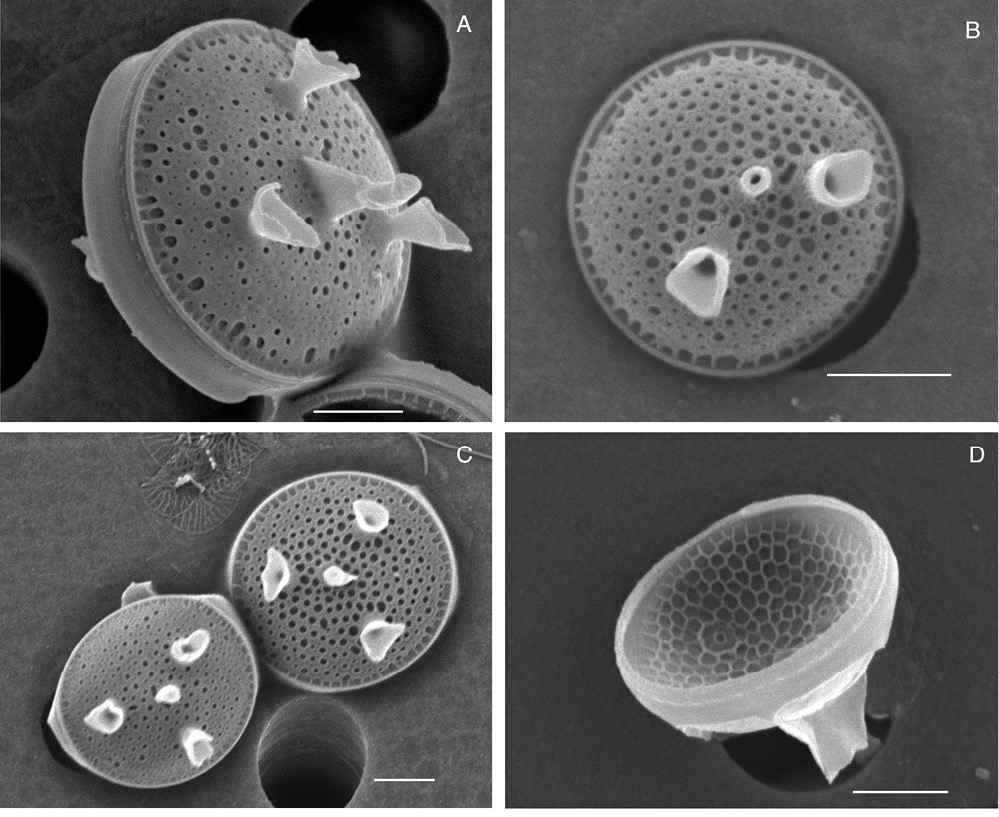 View of Morphological adaptations to small size in the marine diatom ...
